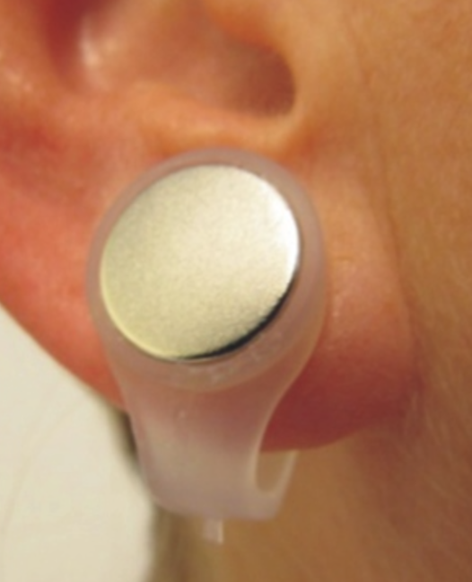 cheloide oreille-001 • macommune.info