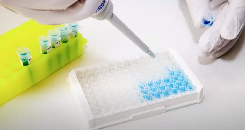 RD-Biotech lauréate “France Relance” pour son futur site de ...